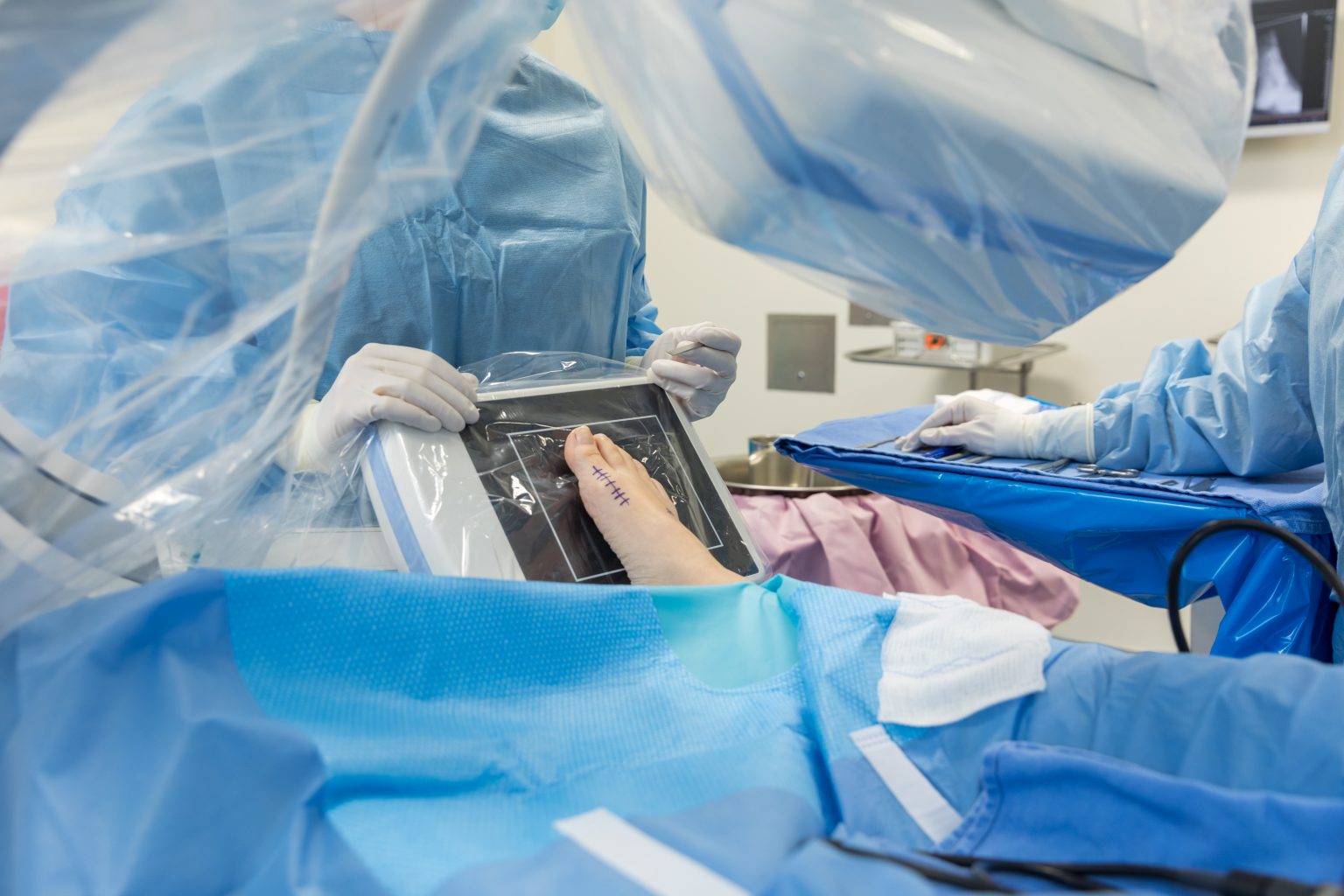 Lapiplasty® 3D Bunion Correction™ with Dr. Gregory Rouw - St. Cloud ...